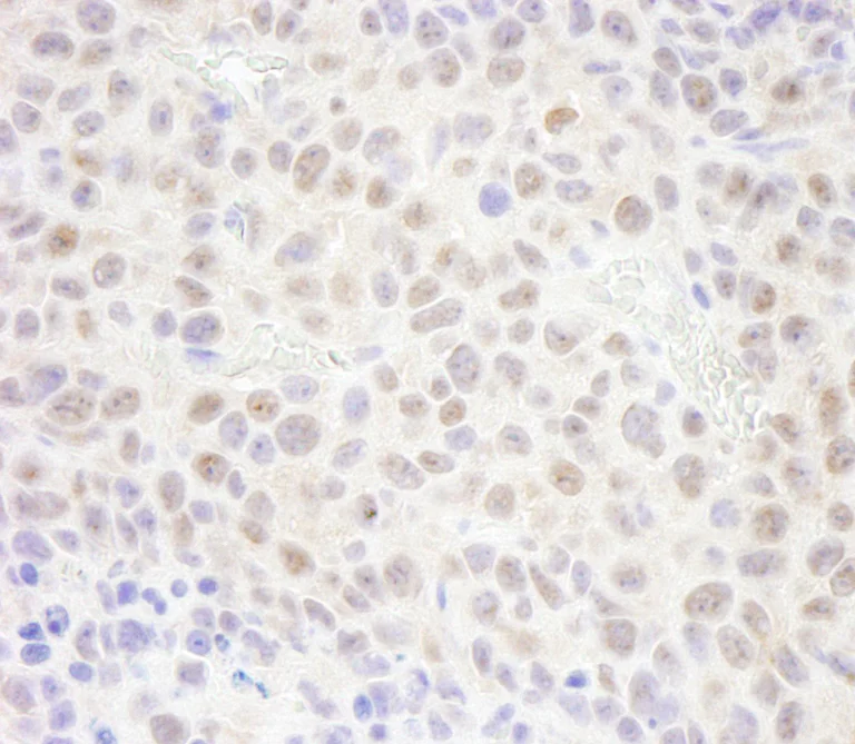 Anti-RPA70 antibody (ab87272) | Abcam