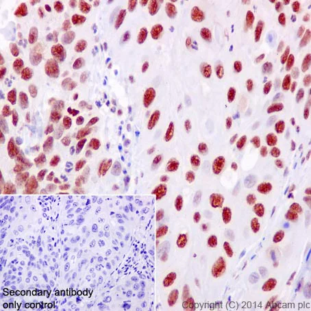 Anti-RPA70 antibody [EPR3472] (ab79398) | Abcam