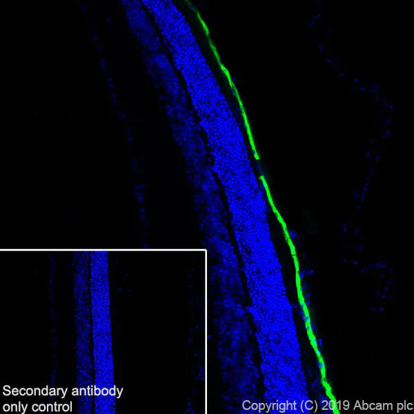 Anti-RPE65 antibody [EPR22579-44] (ab231782) | Abcam