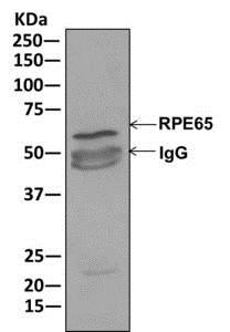 RPE65抗体 (ab235950)| Abcam中文官网