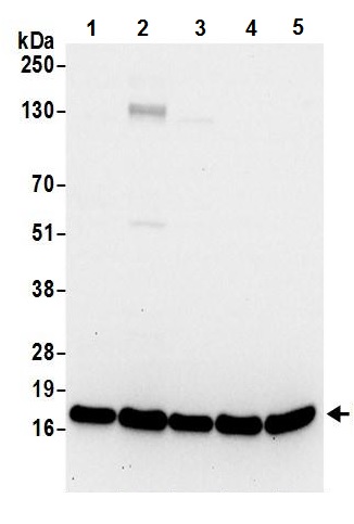 Anti-RPL23 antibody (ab241088) | Abcam