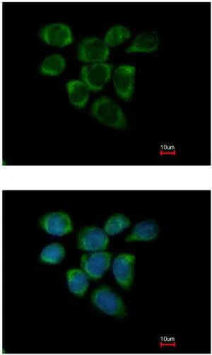 Anti-RPL7A antibody (ab155147) | Abcam