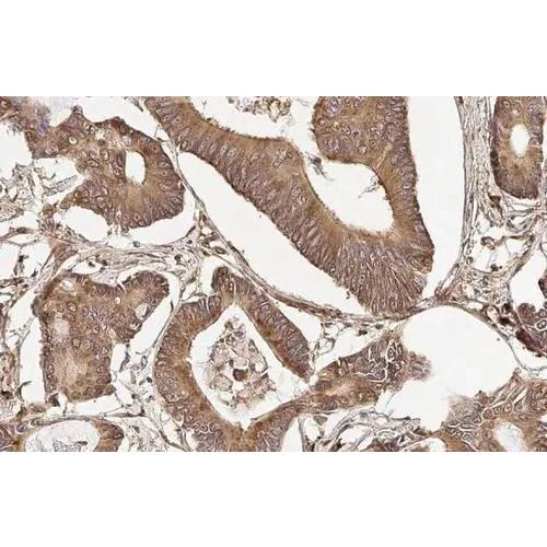Anti-RPLP2 antibody [HL2256] (ab317179) | Abcam中文官网