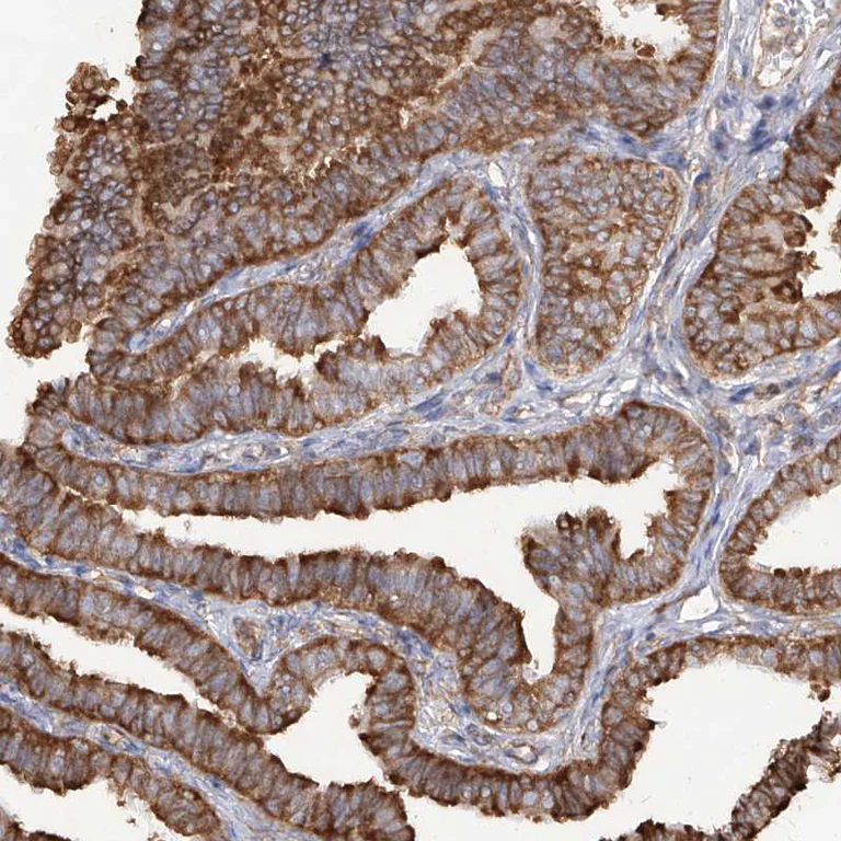 Anti-RPS25 antibody (ab254671) | Abcam