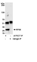 Anti-RPS6 antibody - Ribosome Marker (ab70227) | Abcam
