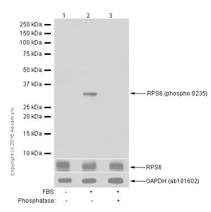 Anti-RPS6 (phospho S235) antibody [EP1338(2)Y] - Ribosome Marker ...