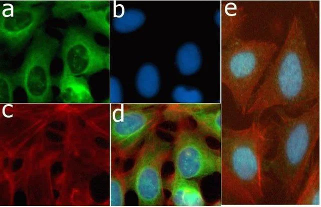 Anti-RPS6 (phospho S235 + S236) antibody [RP23040079] (ab313426) | Abcam