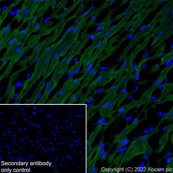 Anti-Ryanodine receptor 2/RYR-2 antibody [EPR26288-70] (ab302716) | Abcam