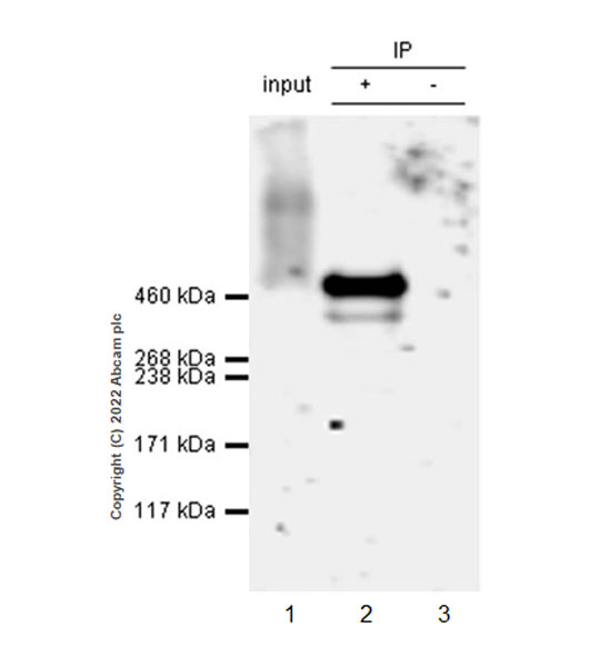 Anti-Ryanodine receptor 2/RYR-2 antibody [EPR26288-70] (ab302716) | Abcam