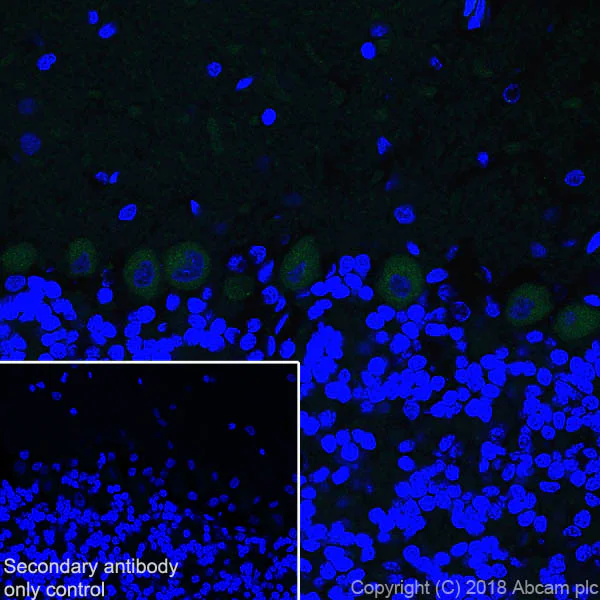 Anti-Ryanodine Receptor antibody [EPR21796] (ab219798) | Abcam