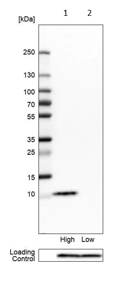 Anti-S100 alpha 6/PRA antibody (ab244301) | Abcam