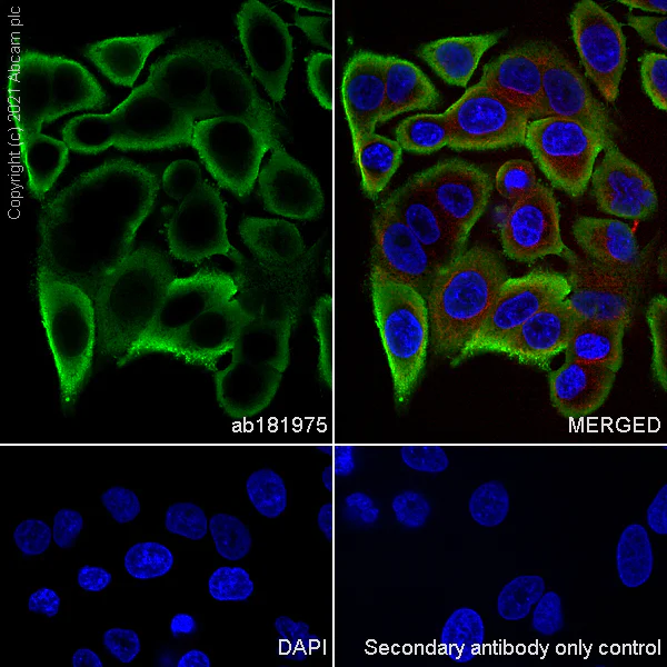 Anti-S100 alpha 6/PRA antibody [EPR13084-69] (ab181975) | Abcam