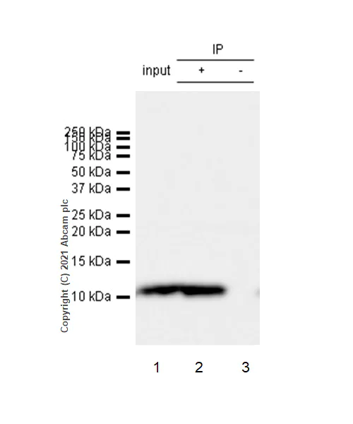 Anti-S100 alpha 6/PRA antibody [EPR13084-69] (ab181975) | Abcam
