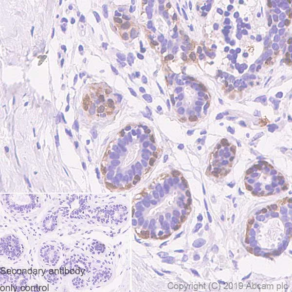 Anti-S100 beta antibody [SP127] - Astrocyte Marker (ab115803) | Abcam