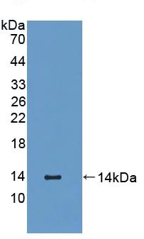 Anti-S100A12/CGRP antibody (ab231654) | Abcam