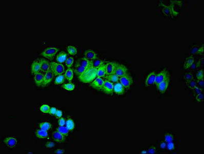 Anti-S31 antibody (ab236651) | Abcam
