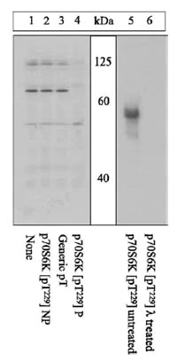 Anti-S6K1 (phospho T229) antibody (ab5231) | Abcam