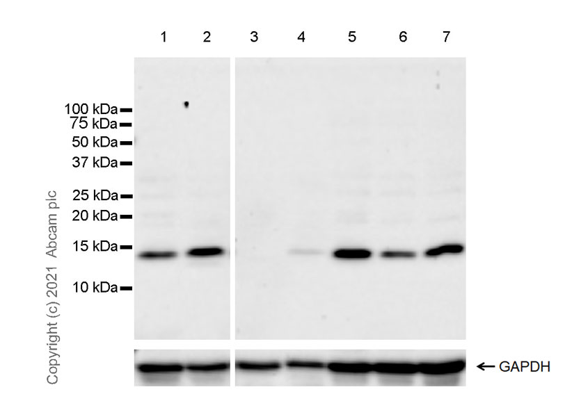 Anti-SAA3 antibody [EPR23102-242] 20 ul size (ab233547) | Abcam
