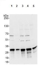 Anti-SAP30 antibody (ab125187) | Abcam