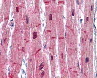 Sarcomeric Alpha Actinin抗体 (ab113086)| Abcam中文官网