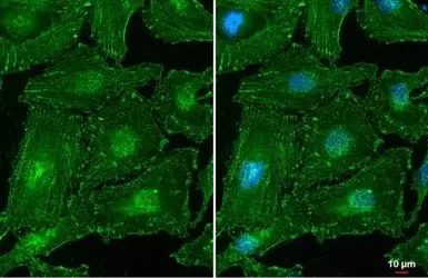 Sarcomeric Alpha Actinin抗体 (ab137346)| Abcam中文官网