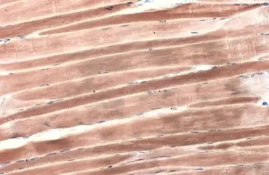 Sarcomeric Alpha Actinin抗体 (ab137346)| Abcam中文官网