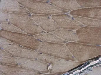 Sarcomeric Alpha Actinin抗体 (ab137346)| Abcam中文官网