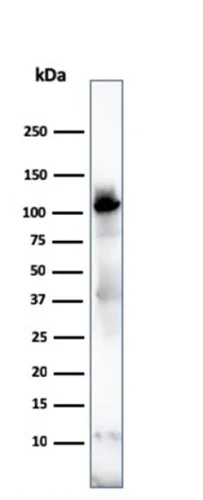 Anti-Sarcomeric Alpha Actinin antibody [ACTN2/3292] (ab257317) | Abcam