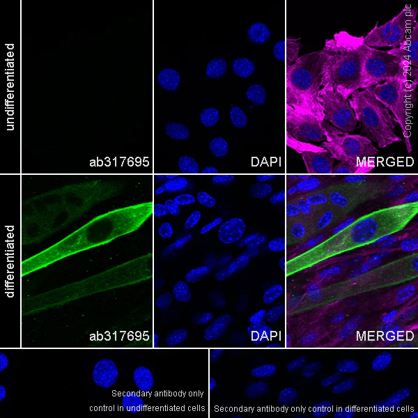 Anti-Sarcomeric Alpha Actinin antibody [EPR28776-83] (ab317695) | Abcam