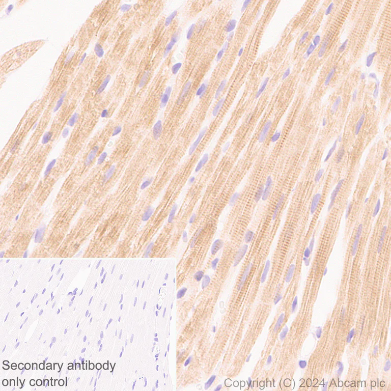 Sarcomeric Alpha Actinin抗体[EPR28776-83] (ab317695)| Abcam中文官网