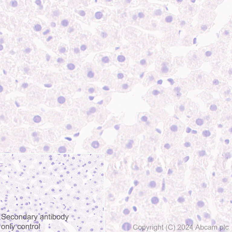 Anti-Sarcomeric Alpha Actinin antibody [EPR28776-83] (ab317695) | Abcam