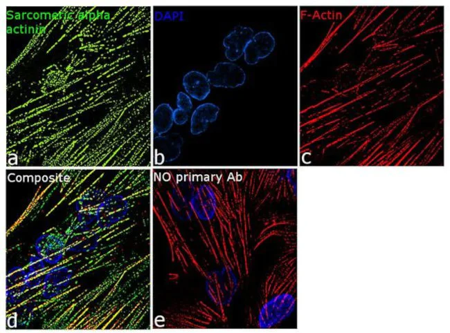 Anti-Sarcomeric Alpha Actinin antibody [RP23040128] (ab313448) | Abcam