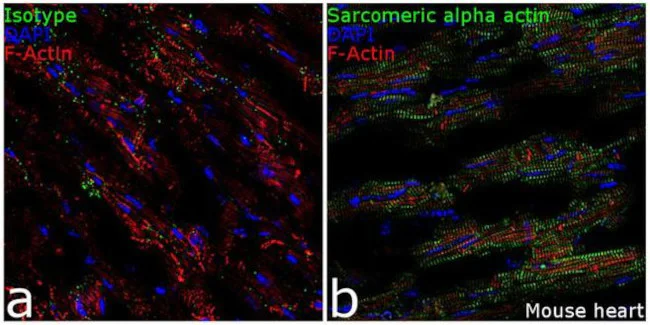 Anti-Sarcomeric Alpha Actinin antibody [RP23040128] (ab313448) | Abcam