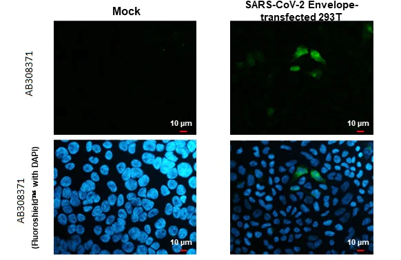 Anti-SARS CoV 2 COVID 19 Envelope antibody [HL1443] - BSA and Azide ...