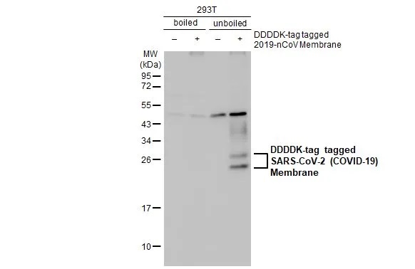 Anti-SARS CoV 2 COVID 19 Membrane antibody [HL1087] (ab308339) | Abcam