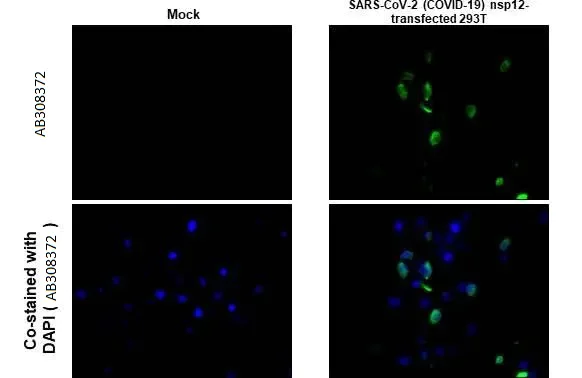 Anti-SARS CoV 2 COVID 19 nsp12 RdRP antibody [HL1444] - BSA and Azide free (ab308372) | Abcam