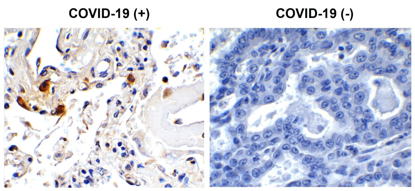 Anti-SARS-CoV-2 envelope protein antibody - Coronavirus (ab272503) | Abcam