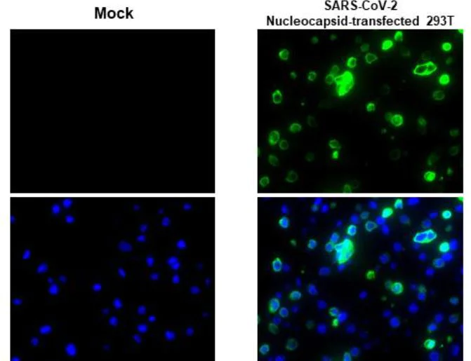 Anti-SARS-CoV-2 nucleocapsid protein antibody [HL249] - BSA and Azide free (ab281295) | Abcam