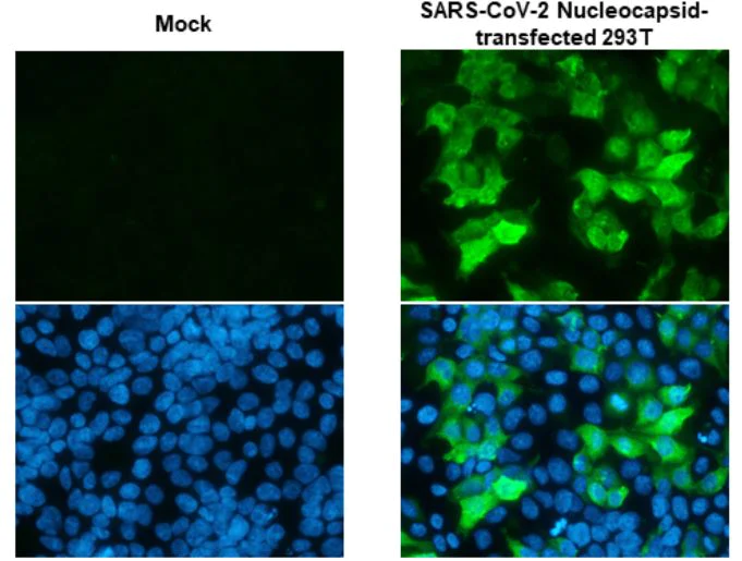 Anti-SARS-CoV-2 nucleocapsid protein 抗体 [HL455-MS] - BSA and Azide free (ab281300)