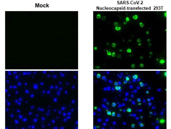 Anti-SARS-CoV-2 nucleocapsid protein antibody [HL455-MS] - BSA and Azide free (ab281300) | Abcam