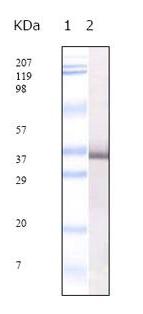 Anti-SARS E2 antibody [4A6C9] - Coronavirus (ab31951) | Abcam