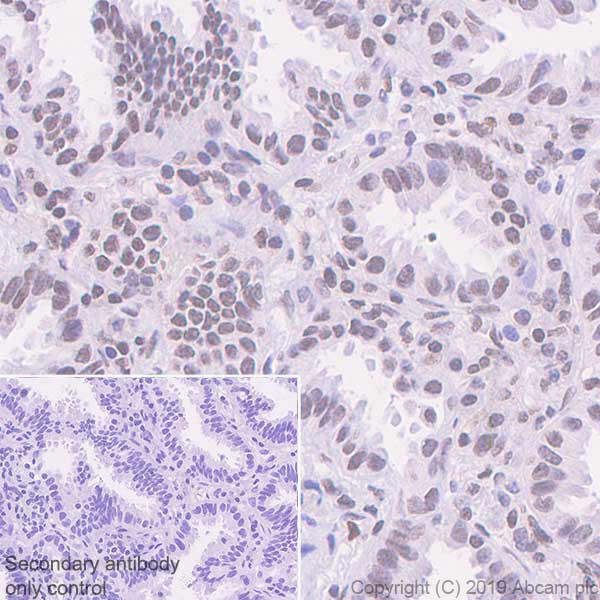Anti-CTIP2 antibody [25B6] (ab18465) | Abcam