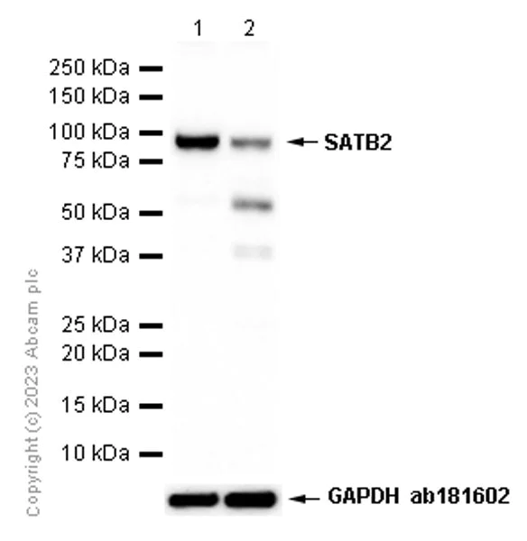 Anti-SATB2 antibody [EPNCIR130B] (ab133328) | Abcam
