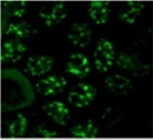 Anti-SC35 antibody - Nuclear Speckle Marker [SC-35] (ab11826) | Abcam