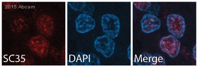 Anti-SC35 antibody - Nuclear Speckle Marker [SC-35] (ab11826) | Abcam