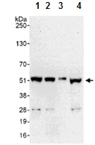 Anti-SCA10 antibody - C-terminal (ab199824) | Abcam