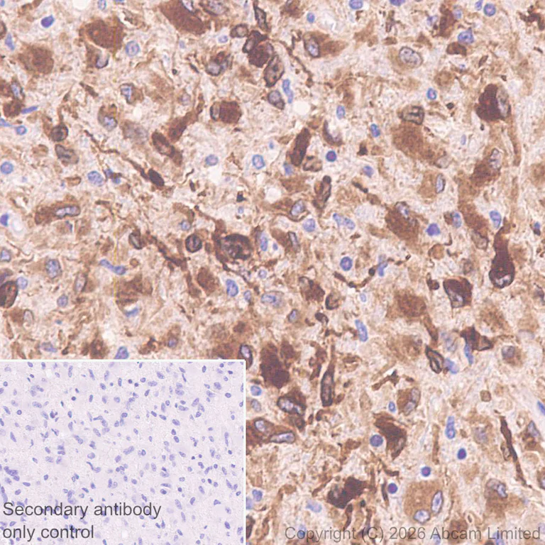 Anti-SCD5 antibody [MJF-D29765-175] - BSA and Azide free (ab327062 ...