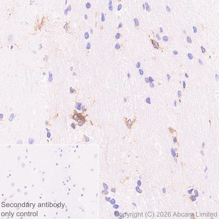 Anti-SCD5 antibody [MJF-D29765-175] - BSA and Azide free (ab327062 ...