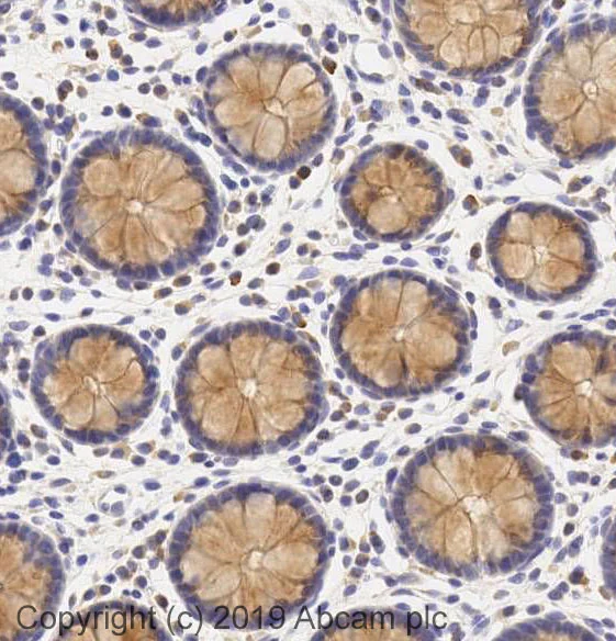 Anti-SCF antibody (ab64677) | Abcam