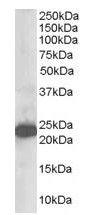 Anti-SCG10 antibody (ab115513) | Abcam
